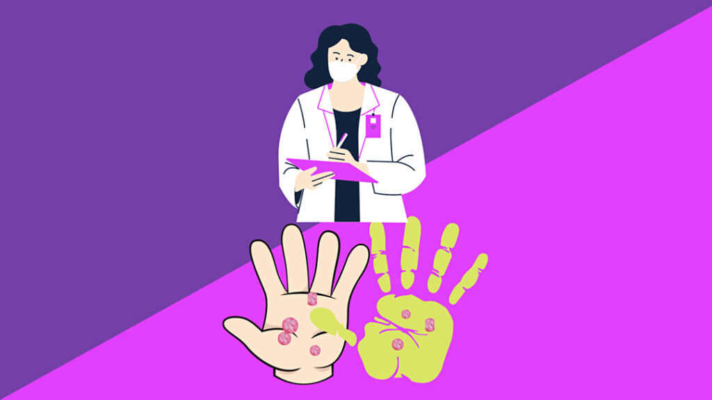 Janeway Lesions | Osler Nodes | FAQ | World Health Support
