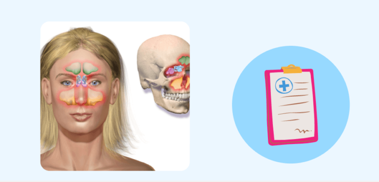 Chronic Sinusitis CT Scan | 2 Safety Issue | World Health