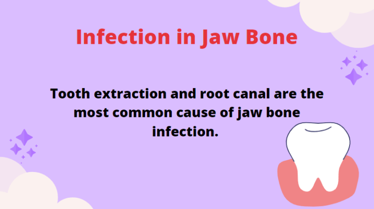 Infection in Jaw Bone | Causes | Symptoms | 12 Best Remedy