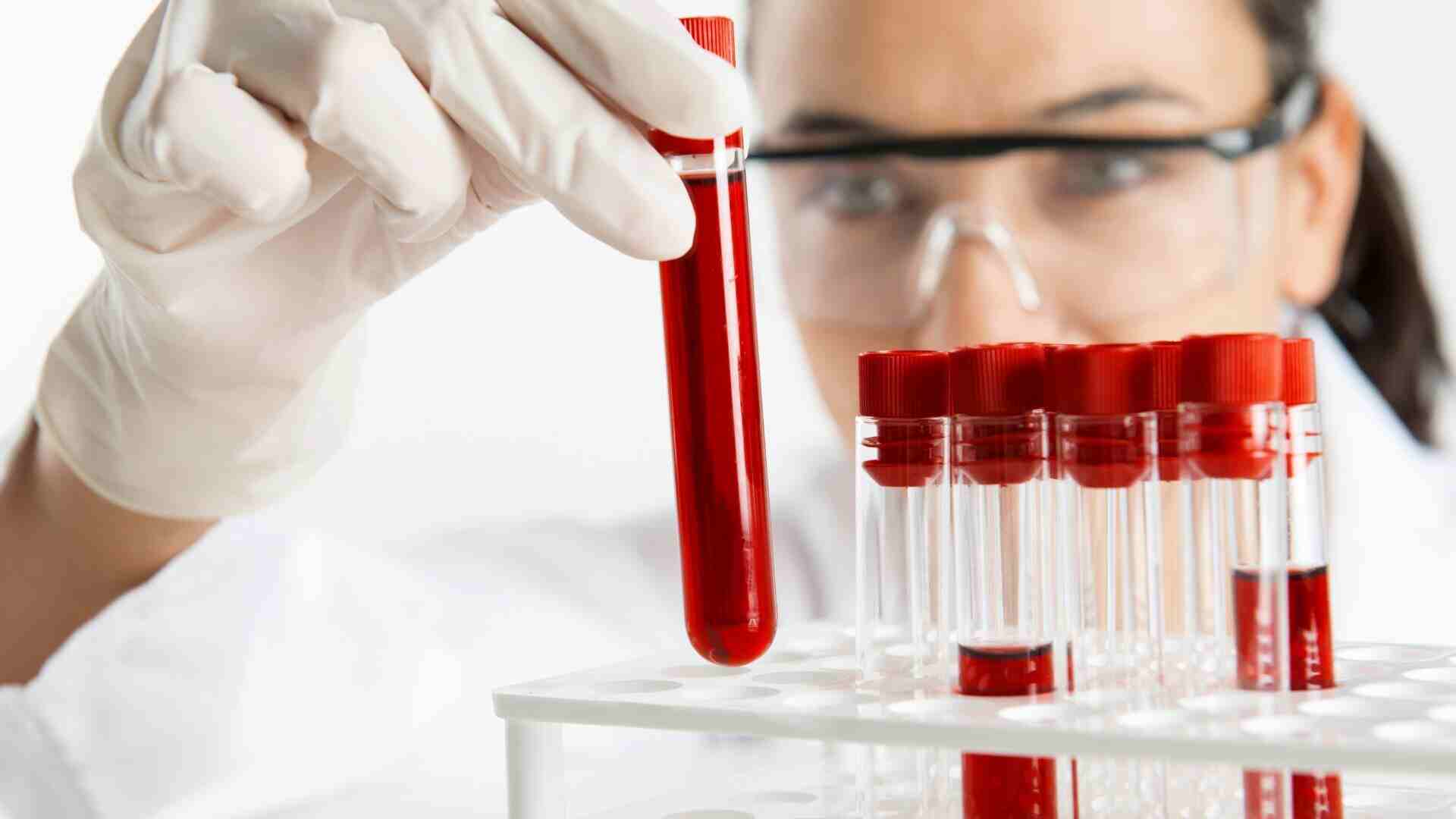 Giving a Blood Sample? Here’s What Happens to Your Sample Afterward ...